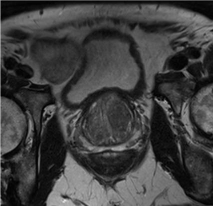 Avancées en imagerie du rein et de la prostate | SFR e-Bulletin