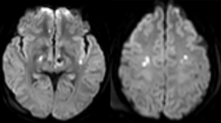 Le traumatisé crânien léger et le radiologue | SFR e-Bulletin